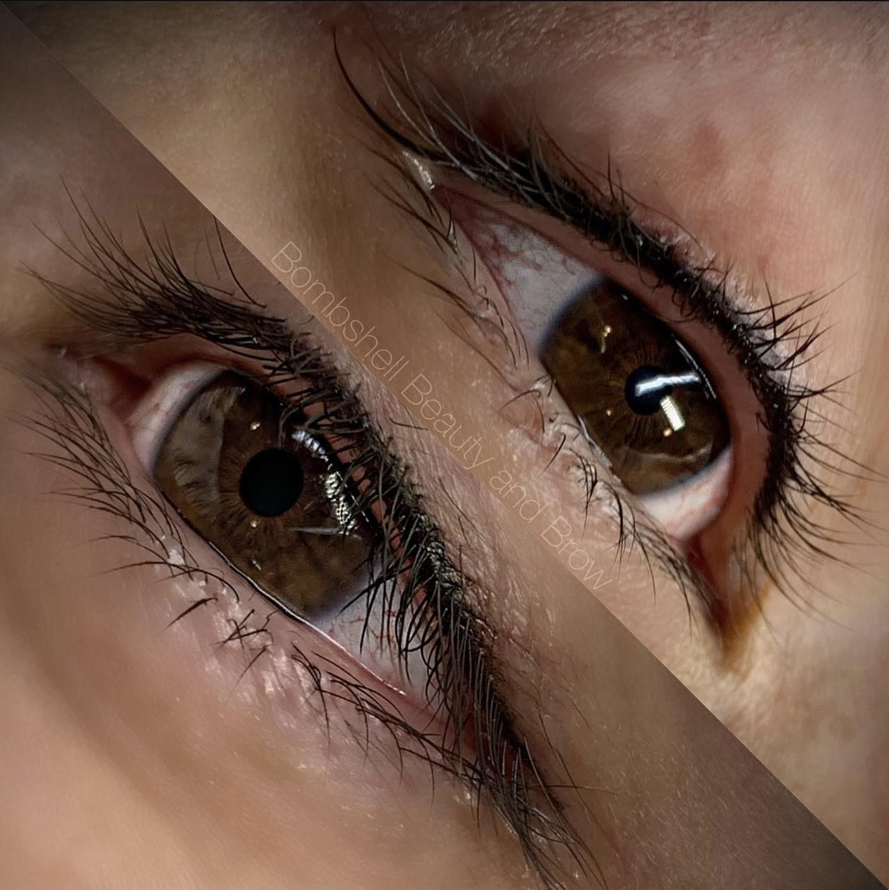 Before And After - Lexington Aesthetics Medical Spa