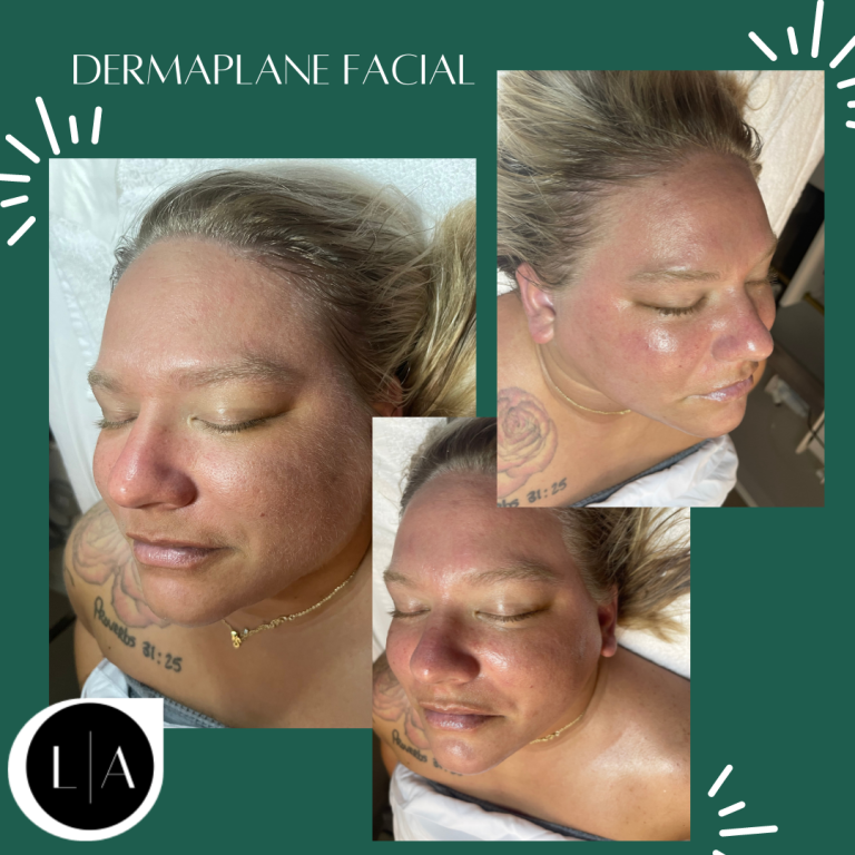 Before And After - Lexington Aesthetics Medical Spa